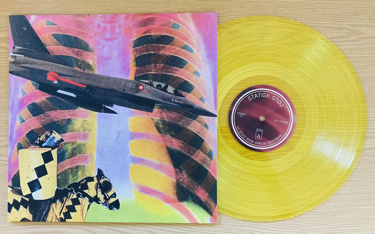 Statisk Støj | Statisk Støj