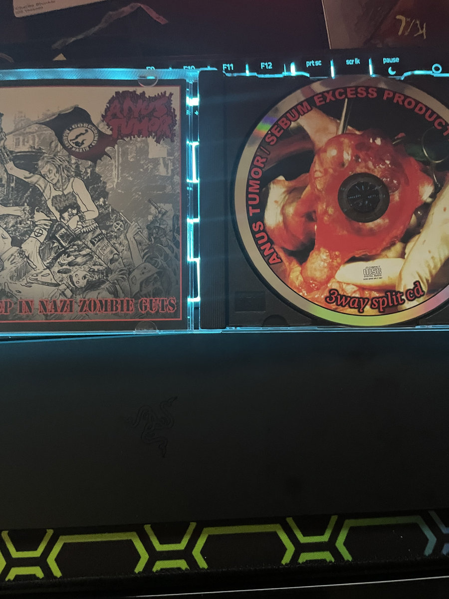 3WayCD | Sebum Excess Production, Anus Tumor, Cannibe | OldgrindereddaysUSA