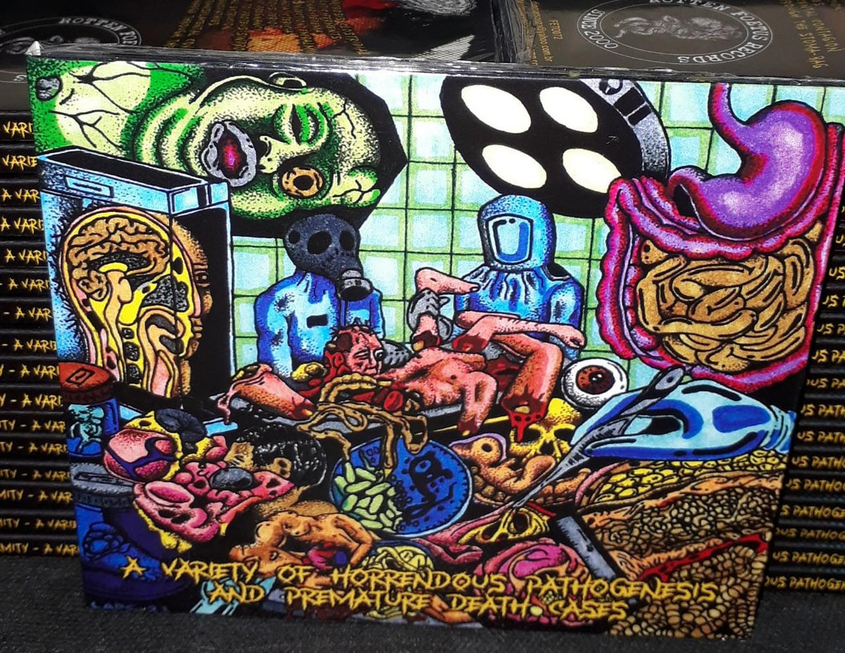 FETAL DEFORMITY: A Variety Of Horrendous Pathogenesis And Premature ...