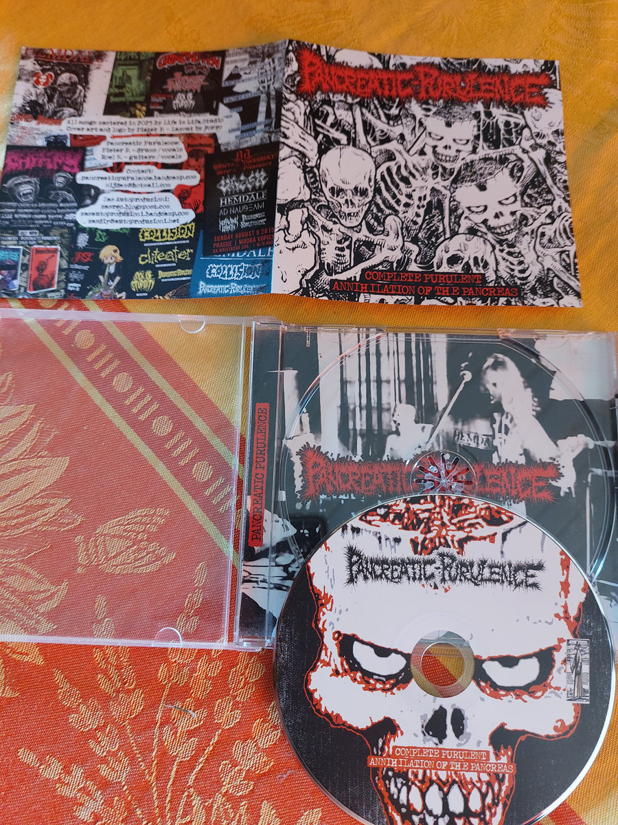 Complete Purulent Annihilation of the Pancreas | Pancreatic Purulence