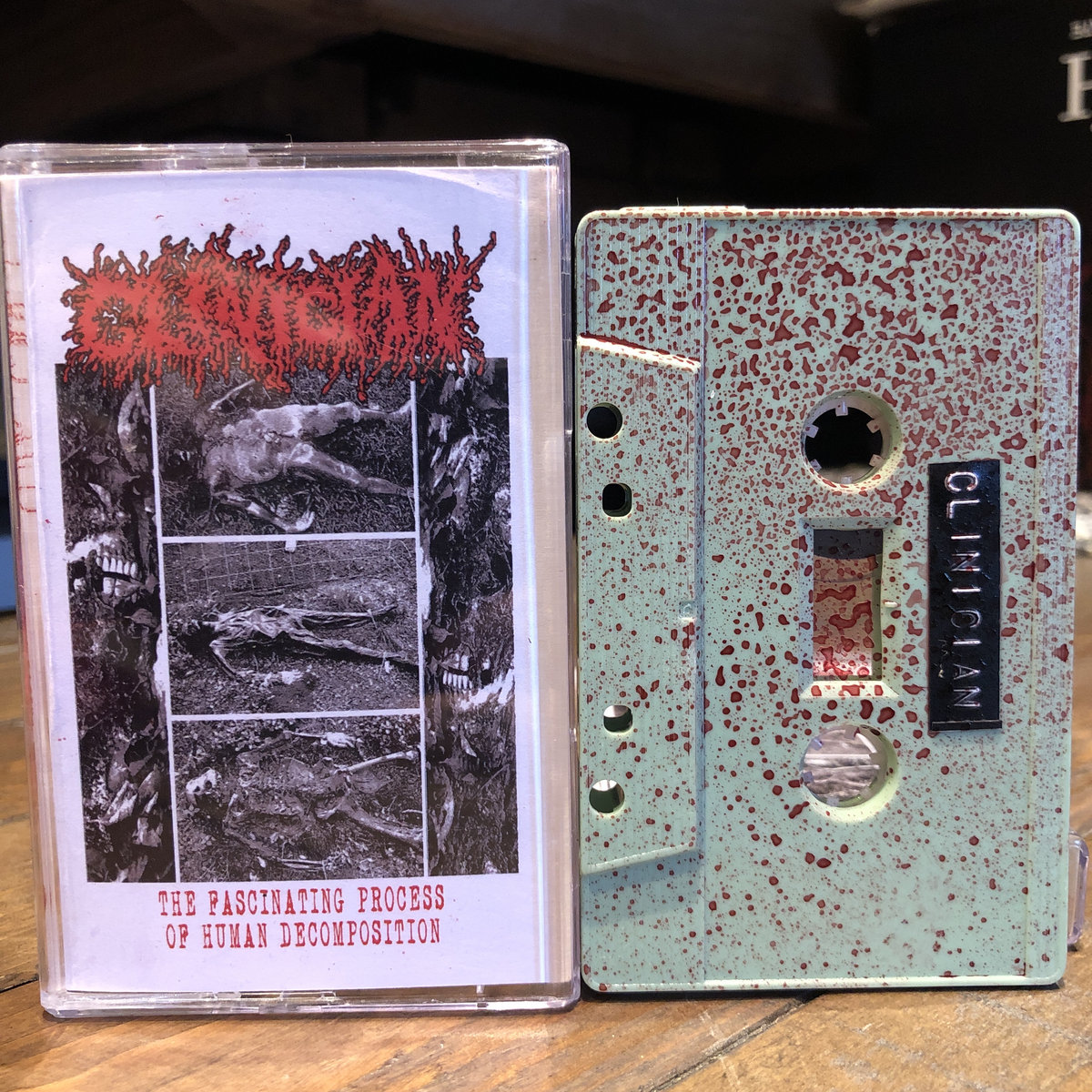 The Fascinating Process Of Human Decomposition | Clinician