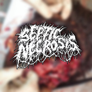 Music | Septic Necrosis
