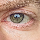 Dark Love, Dark Magic (TRR-DL20) | anaphylaxis