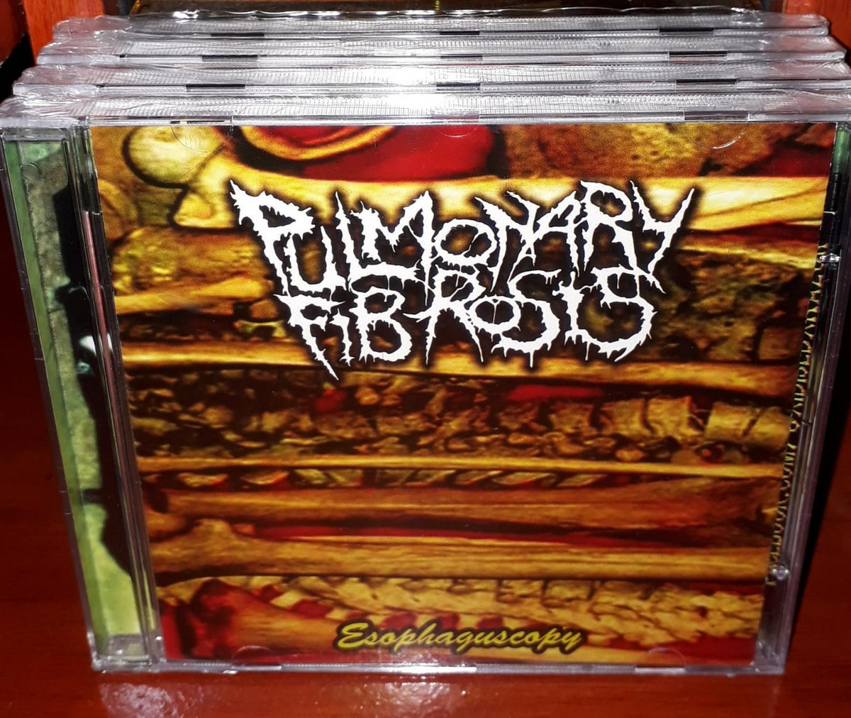 OXIDISED RAZOR / PULMONARY FIBROSIS / BOWEL EVACUATION: 3 Way Split CD ...