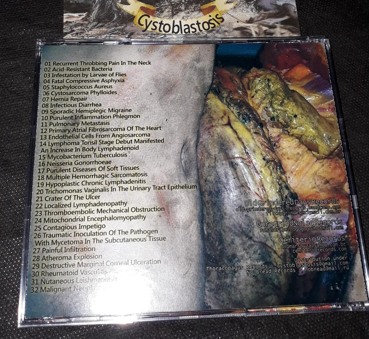 CYSTOBLASTOSIS: Post-Mortem Examination Of Putrid Corpse – Full Album ...