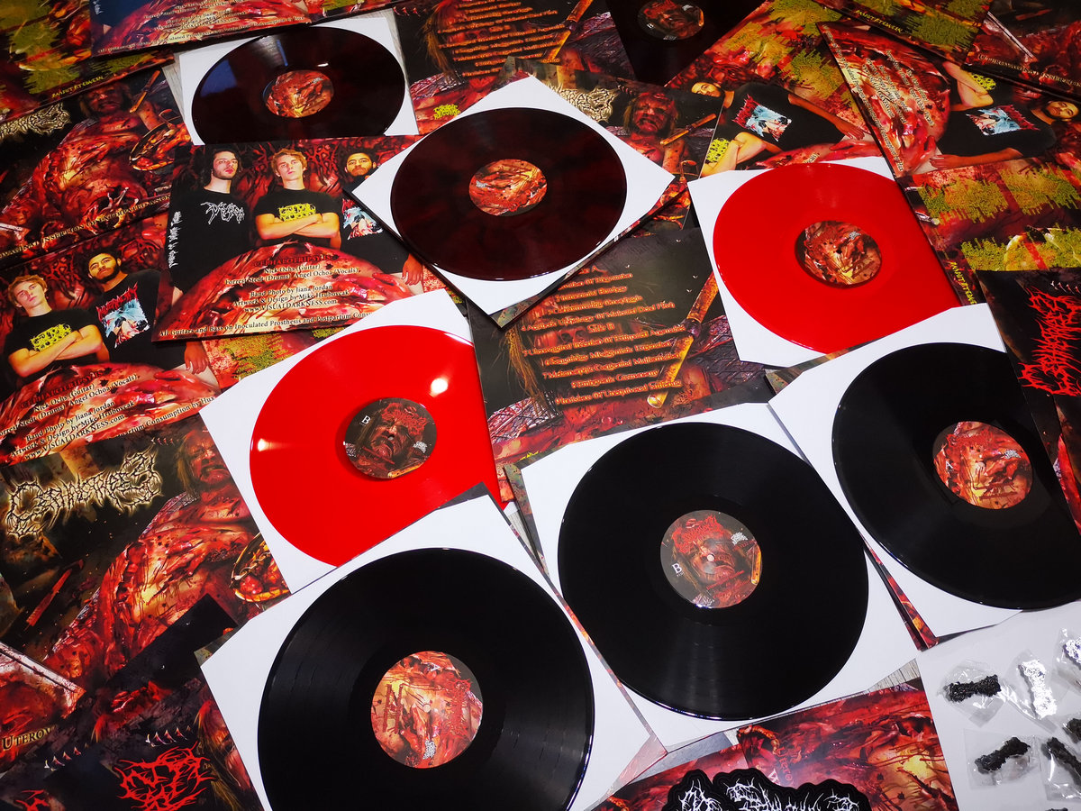 CEPHALOTRIPSY Uterovaginal Insertion Of Extirpated Anomalies Gatefold ...