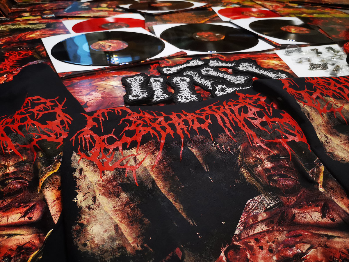 CEPHALOTRIPSY Uterovaginal Insertion Of Extirpated Anomalies PACKAGE ...