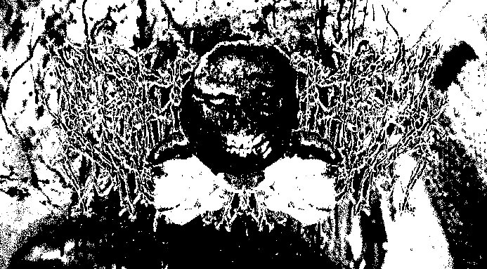 Promo 2024 - A sudden overflow of gastric reflux | Sulfuric Vomit From ...