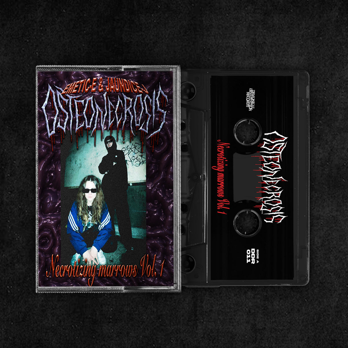 Necrotizing Marrows Vol. 1 | Osteonecrosis | Demonical Devastation Records