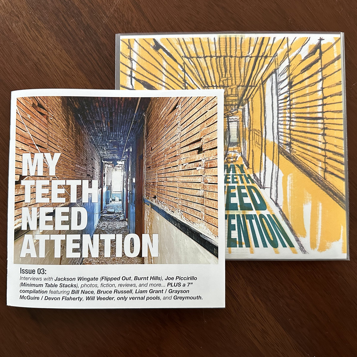 My Teeth Need Attention #3 | Various Artists | Carbon Records