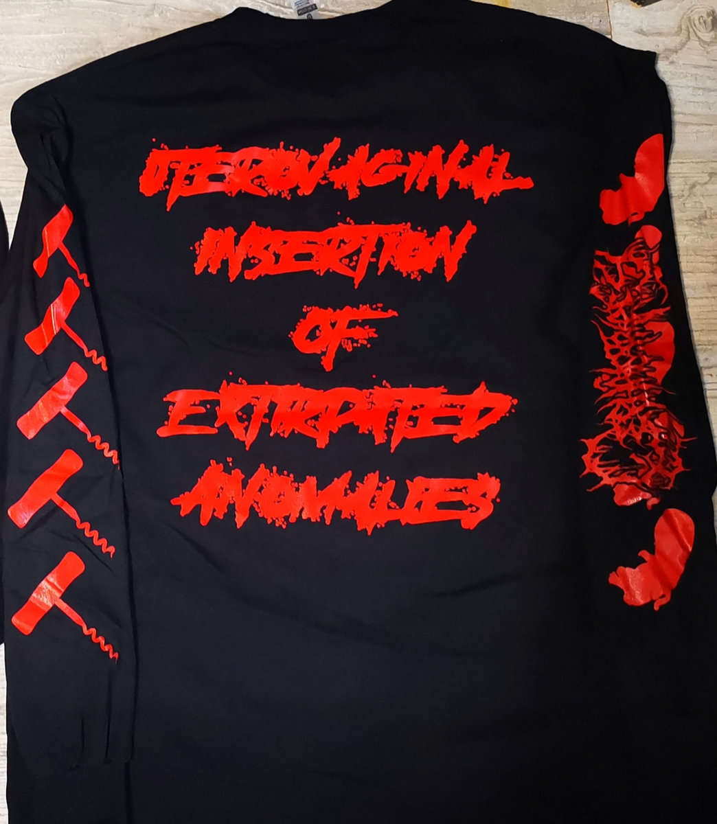 CEPHALOTRIPSY Uterovaginal Insertion Of Extirpated Anomalies Longsleeve ...