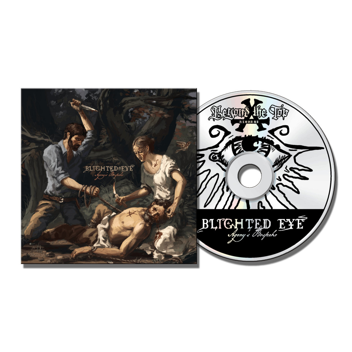 Agony's Bespoke | Blighted Eye | Beyond the Top Records