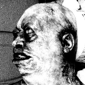 Music | Putrefactive Bloating of Submerged Cadaver with Maggots Exuding ...