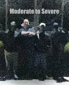 Music | Moderate to Severe