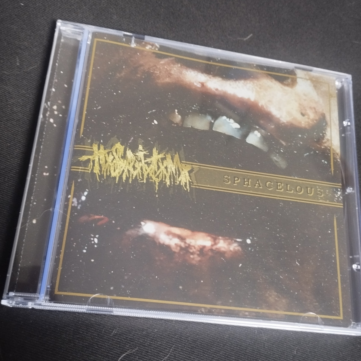 Pre-Diagnosis : Bodies In Advanced Stages Of Decomposition | Human ...