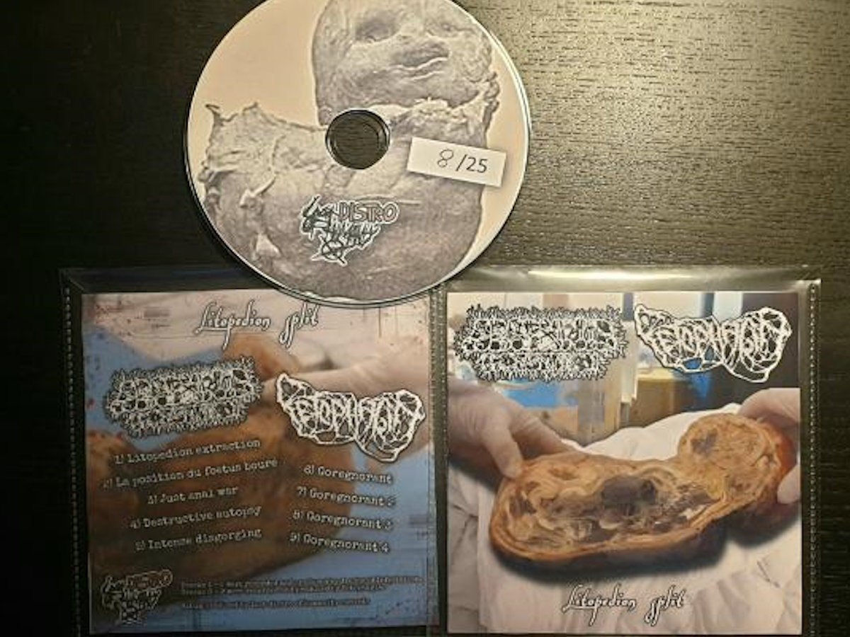 Fetophagia x Arachnid Infestation Split - " Litopedion split " | Fetophagia x Arachnid ...