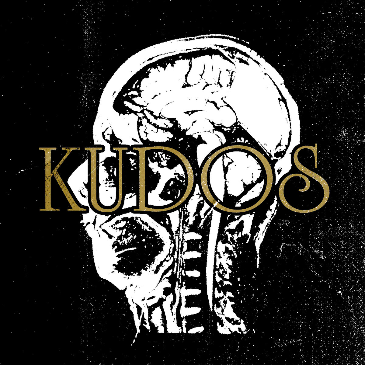 SKISTOSOMIAASI | KUDOS