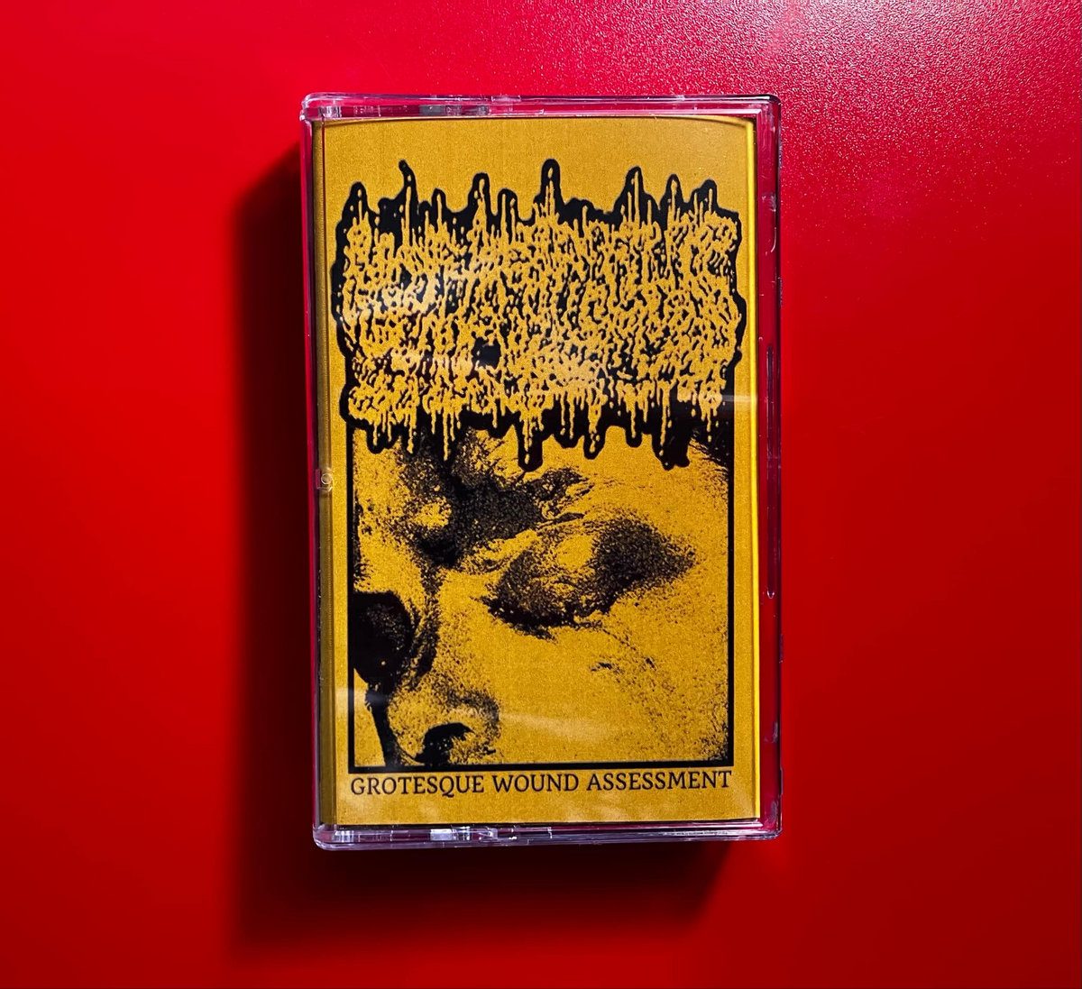 Grotesque Wound Assessment (EP) | Bowel Exhibition | STRANGULATION ...