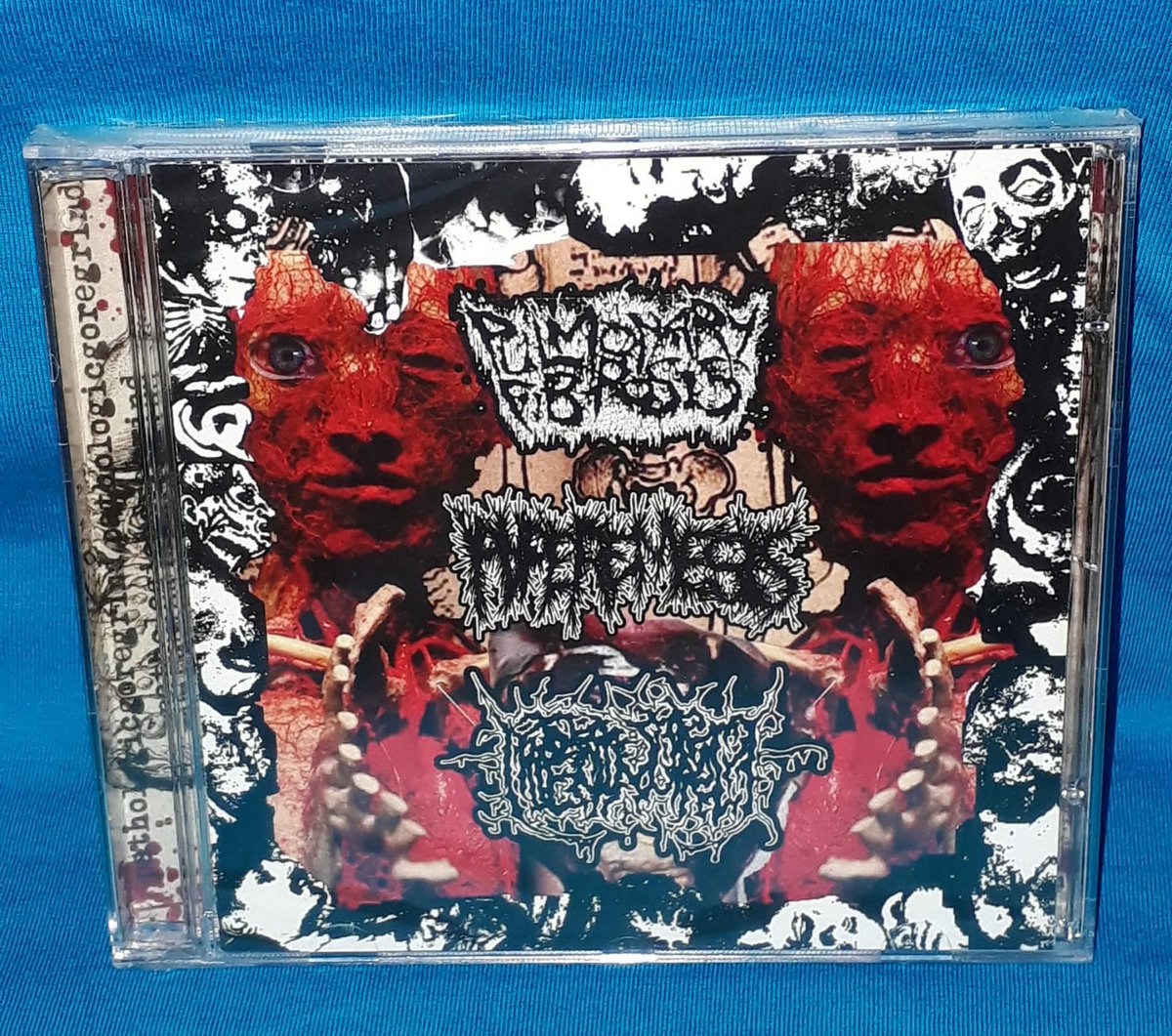 HYPEREMESIS / PULMONARY FIBROSIS / HYPERMENORREA: 3 Way Split CD ...