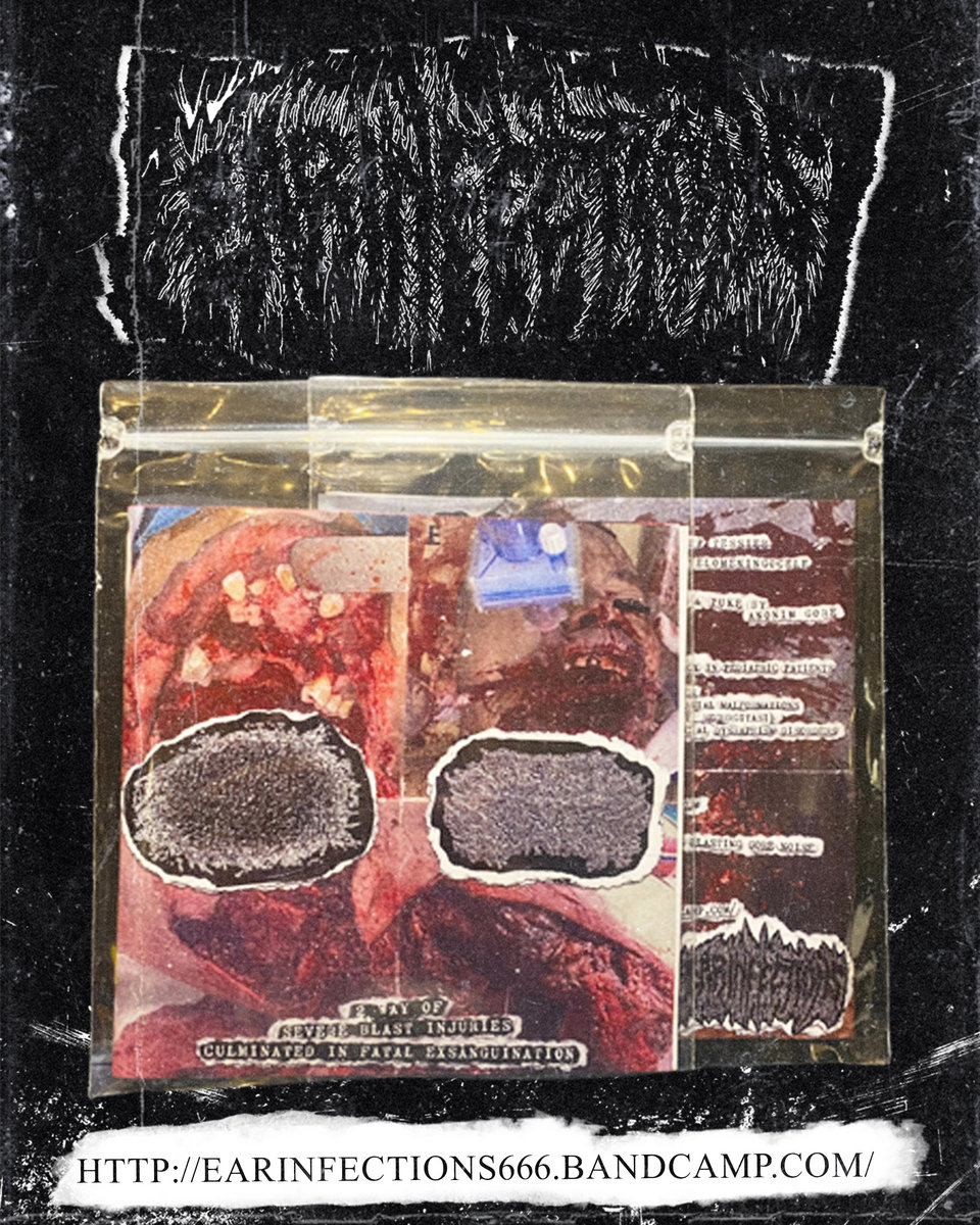 2 Way of Severe Blast Injuries Culminated in Fatal Exsanguination ...