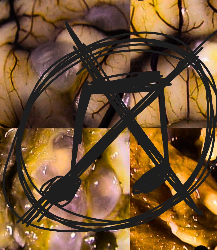 Baburdas | Human Lard