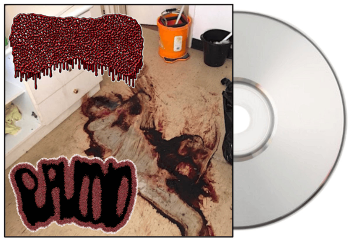 Lymphoedema / Puruloid Split | Puruloid, Lymphoedema | Puruloid