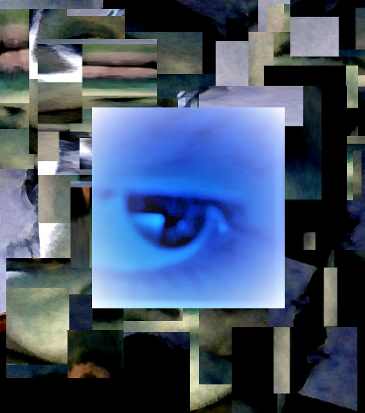 Epilepsy | Kevin