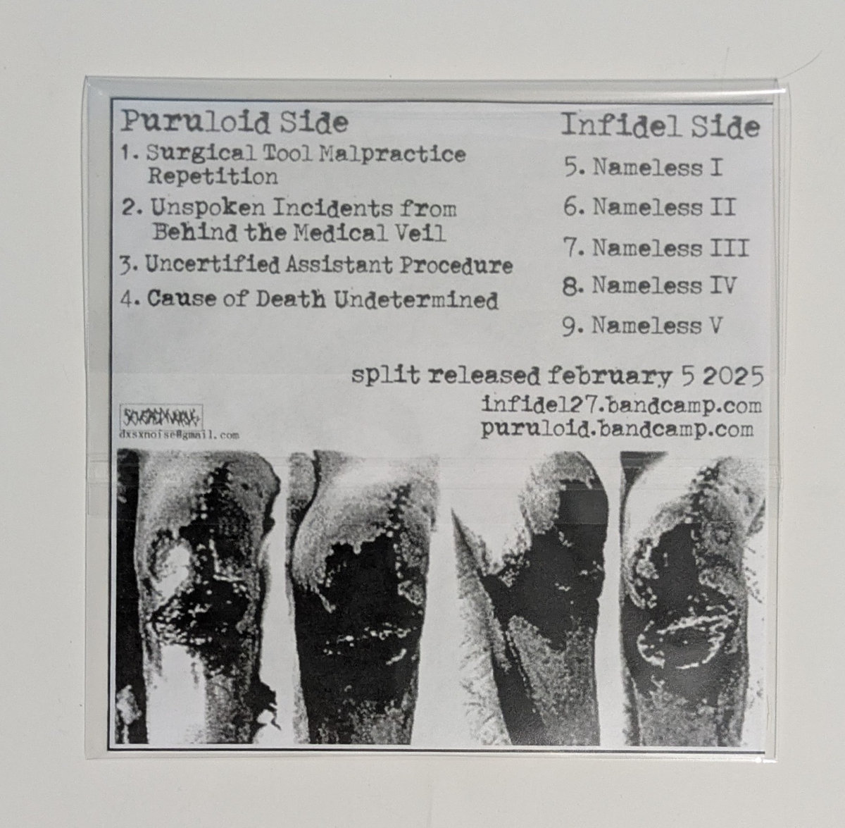 Catalog | Severed Nerve Records