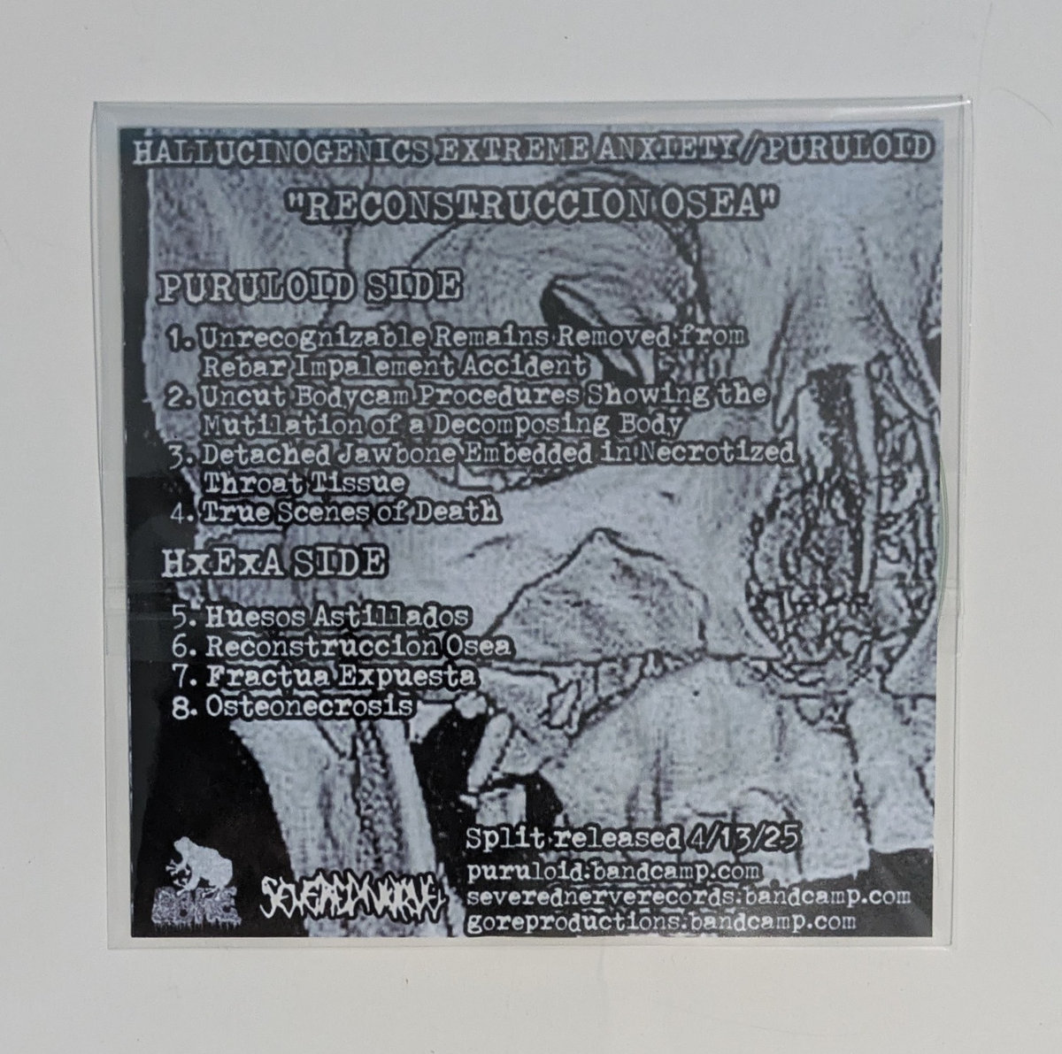 Catalog | Severed Nerve Records