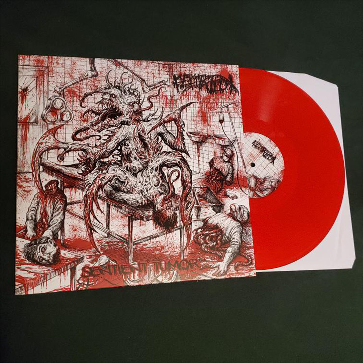 Sentient Tumor | Gestation