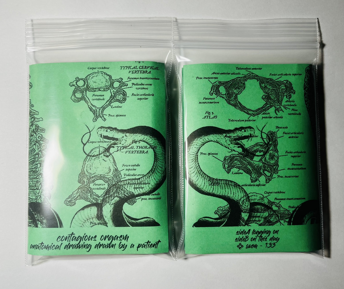 anatomical drawing drawn by a patient | contagious orgasm | sssm