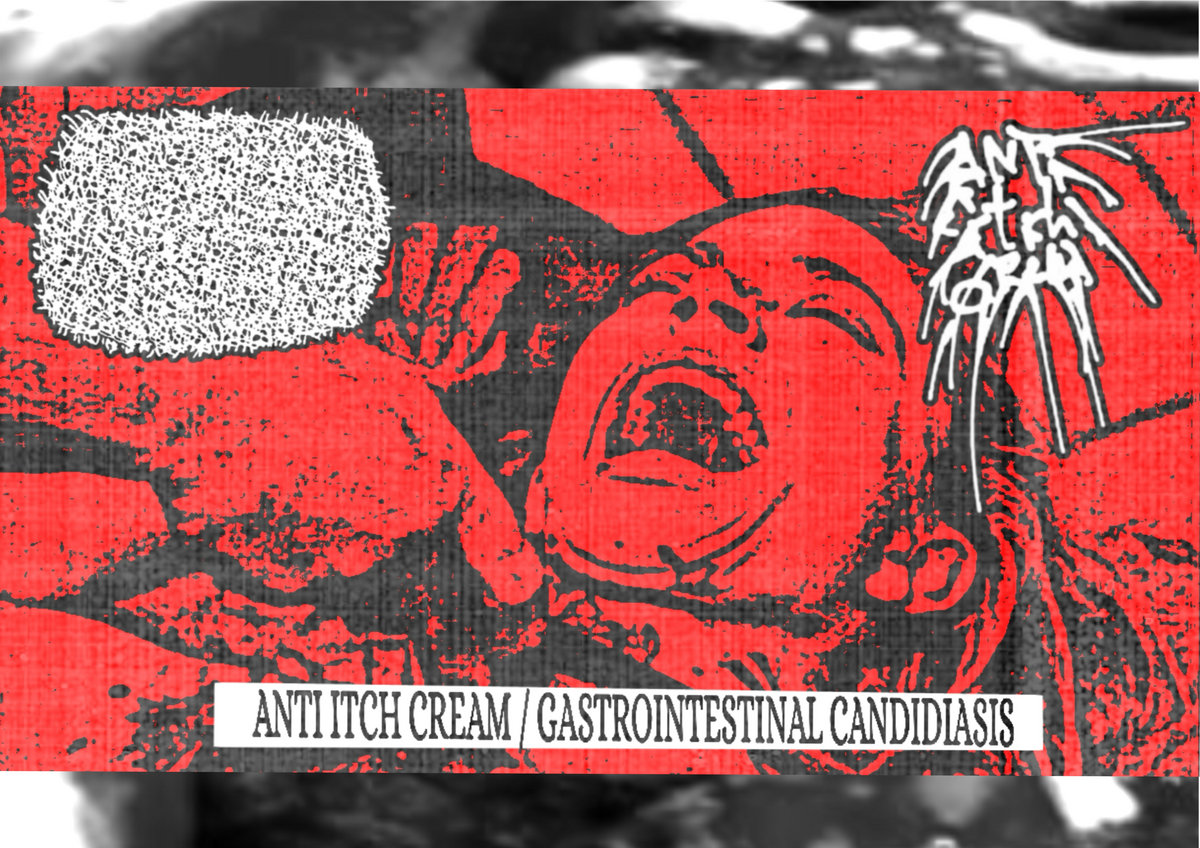 Anti Itch Cream / Gastrointestinal Candidiasis split A4 poster print ...