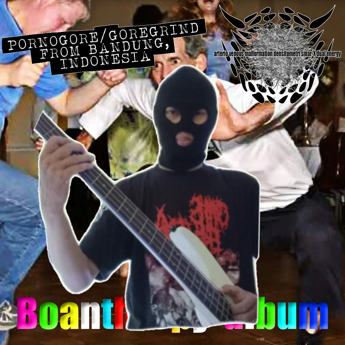 Boanthropy | AxVxMxDxSxXxDxEx | ARTERIO VENOUS MALFORMATION ...