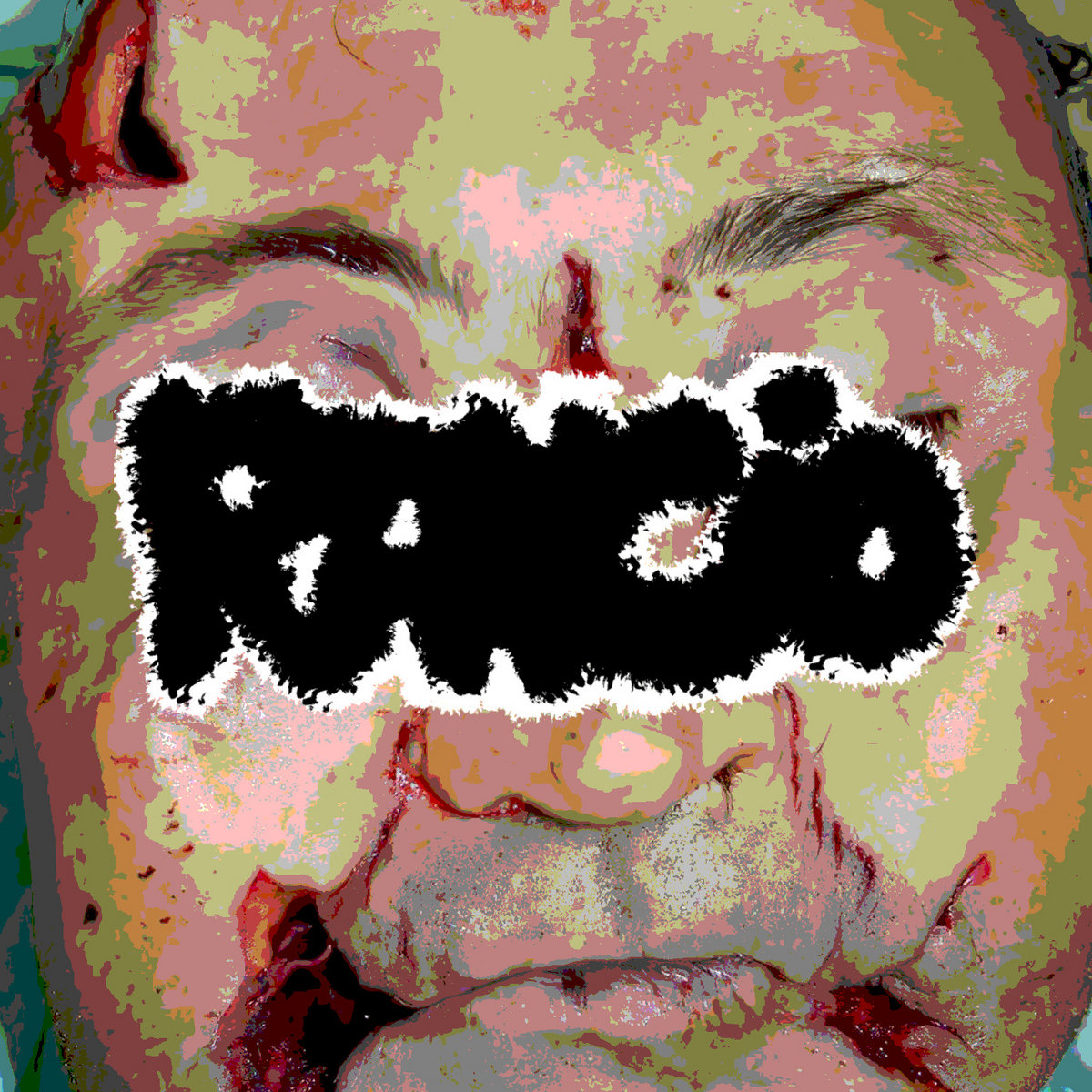 Miasis cutánea (Split with mincen weed) | Rancio