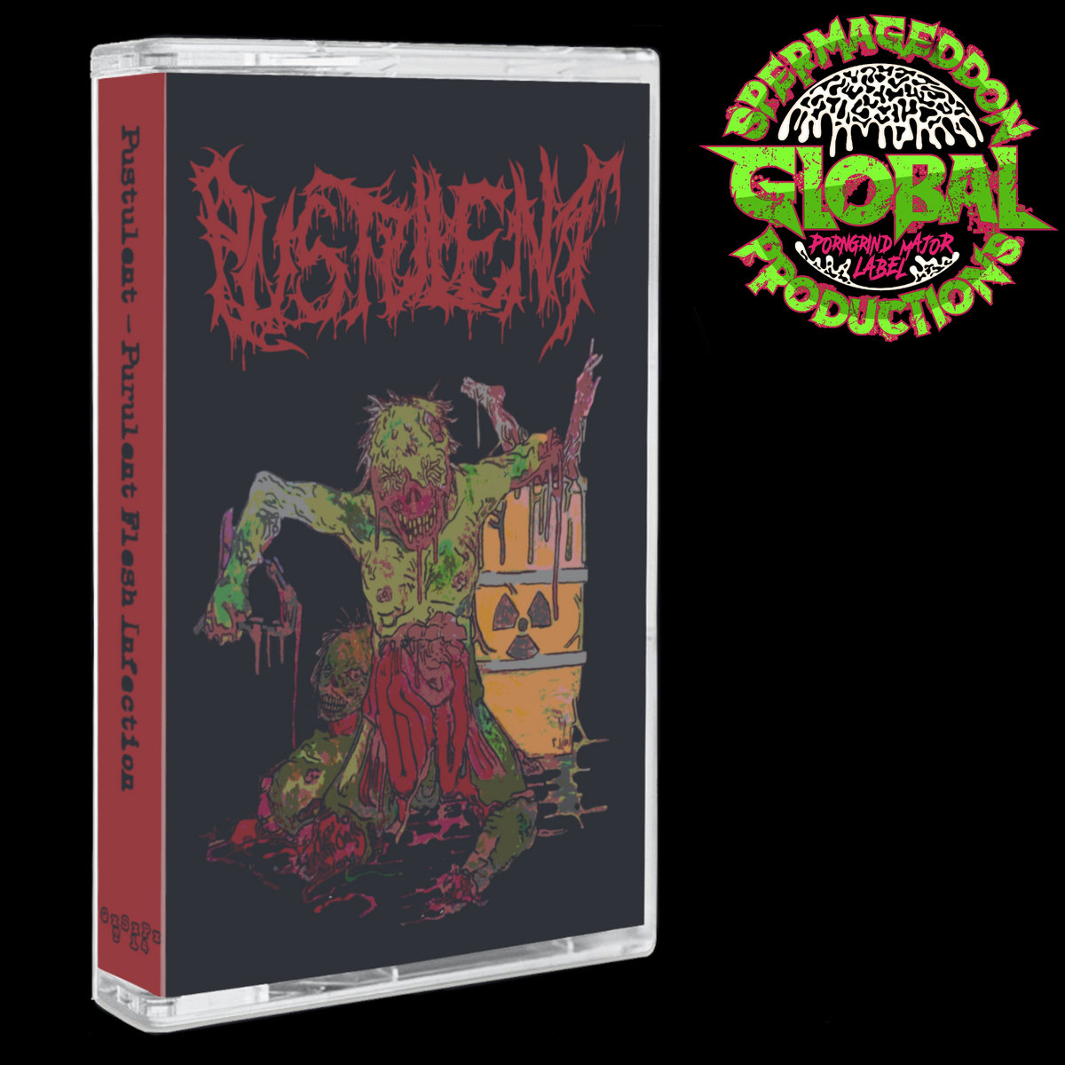 Purulent Flesh Infection | Pustulent | GxSxPx
