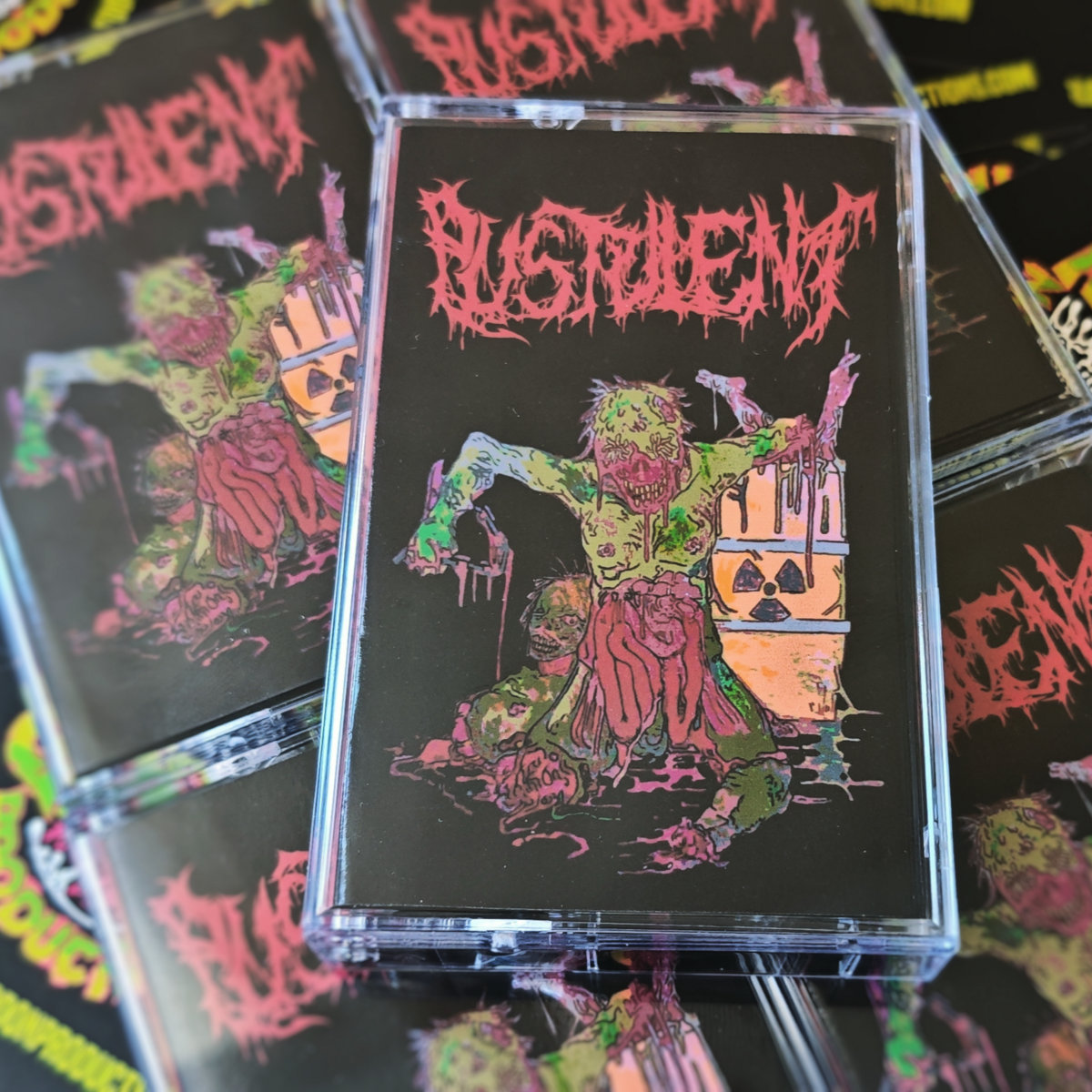 Purulent Flesh Infection | Pustulent | GxSxPx