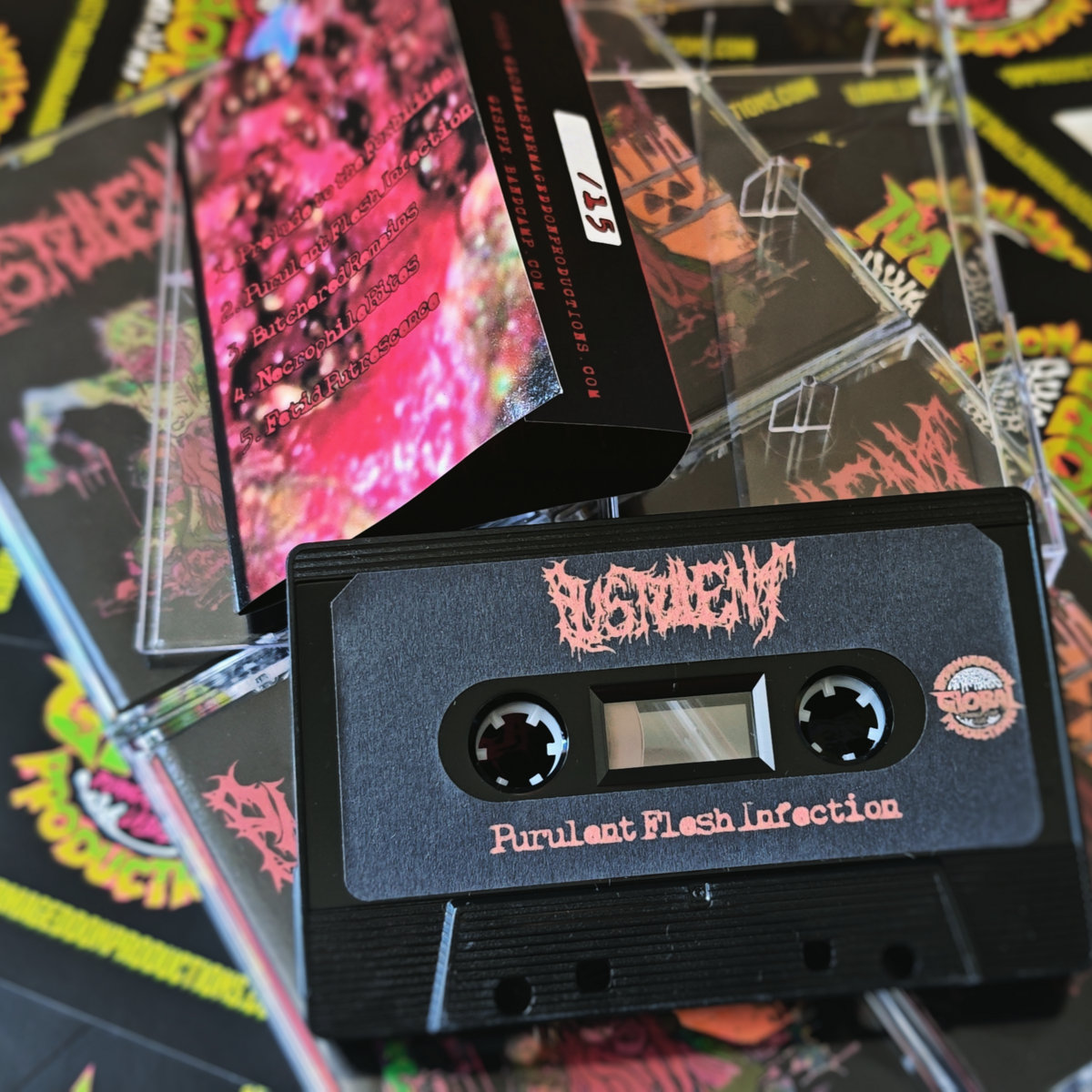 Purulent Flesh Infection | Pustulent | GxSxPx