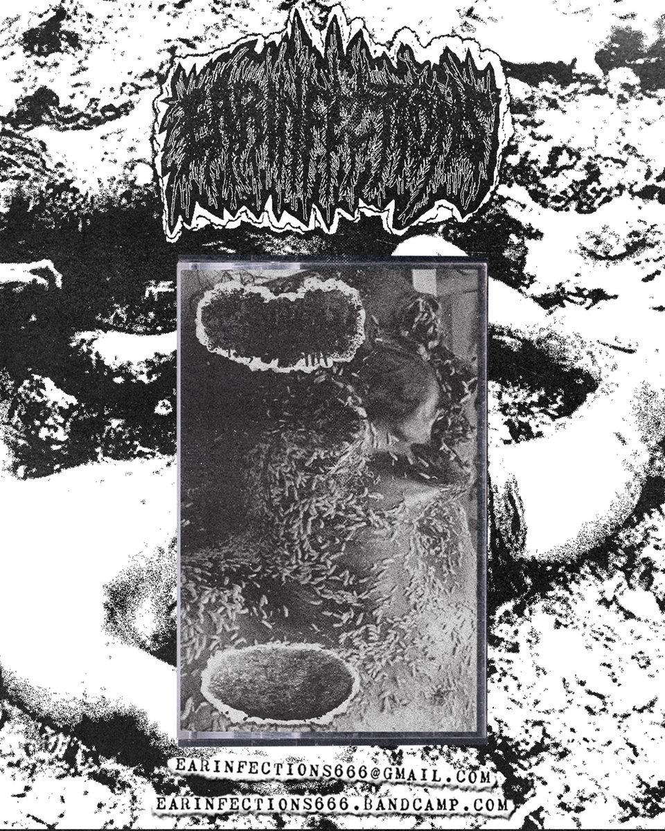 Split | Stercoraceous Copremesis Rhinorrhea ...