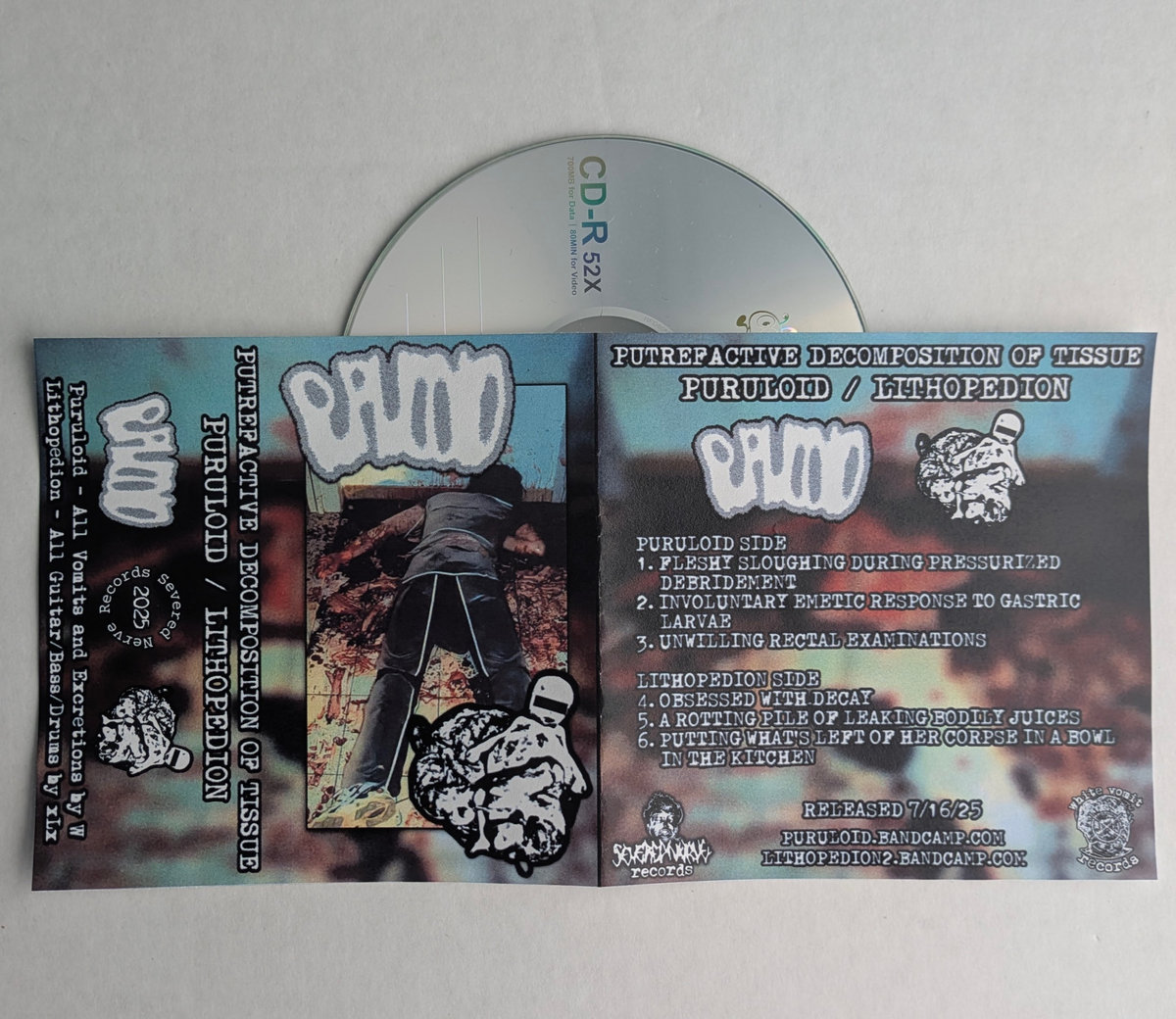 Puruloid / Lithopedion | Puruloid / Lithopedion | Severed Nerve Records