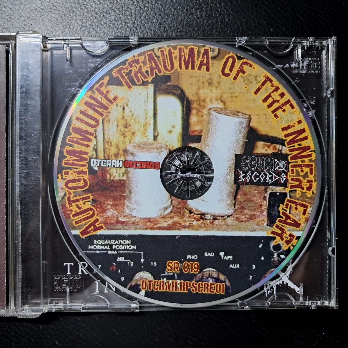 Autoimmune Trauma of the Inner Ear | Shunga no Ie 「春 画 の 家」