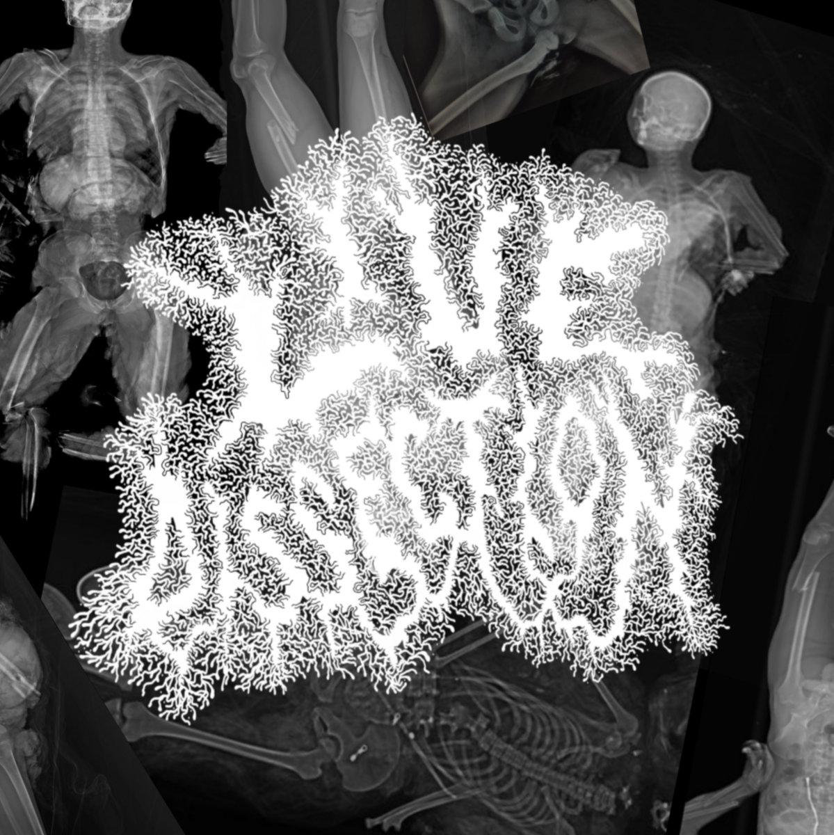DEMO | Live Dissection
