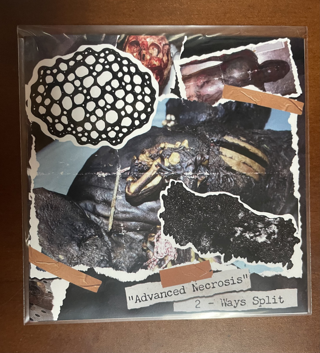 "Advanced Necrosis" (Split W/ Degenerates Boiled Alive In Raw Human ...