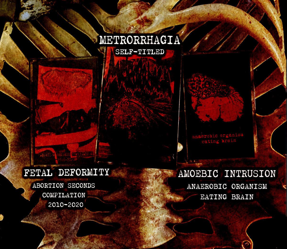 GOREGRIND TRIPLE THREAT BUNDLE - Metrerrohagia, Fetal Deformity ...