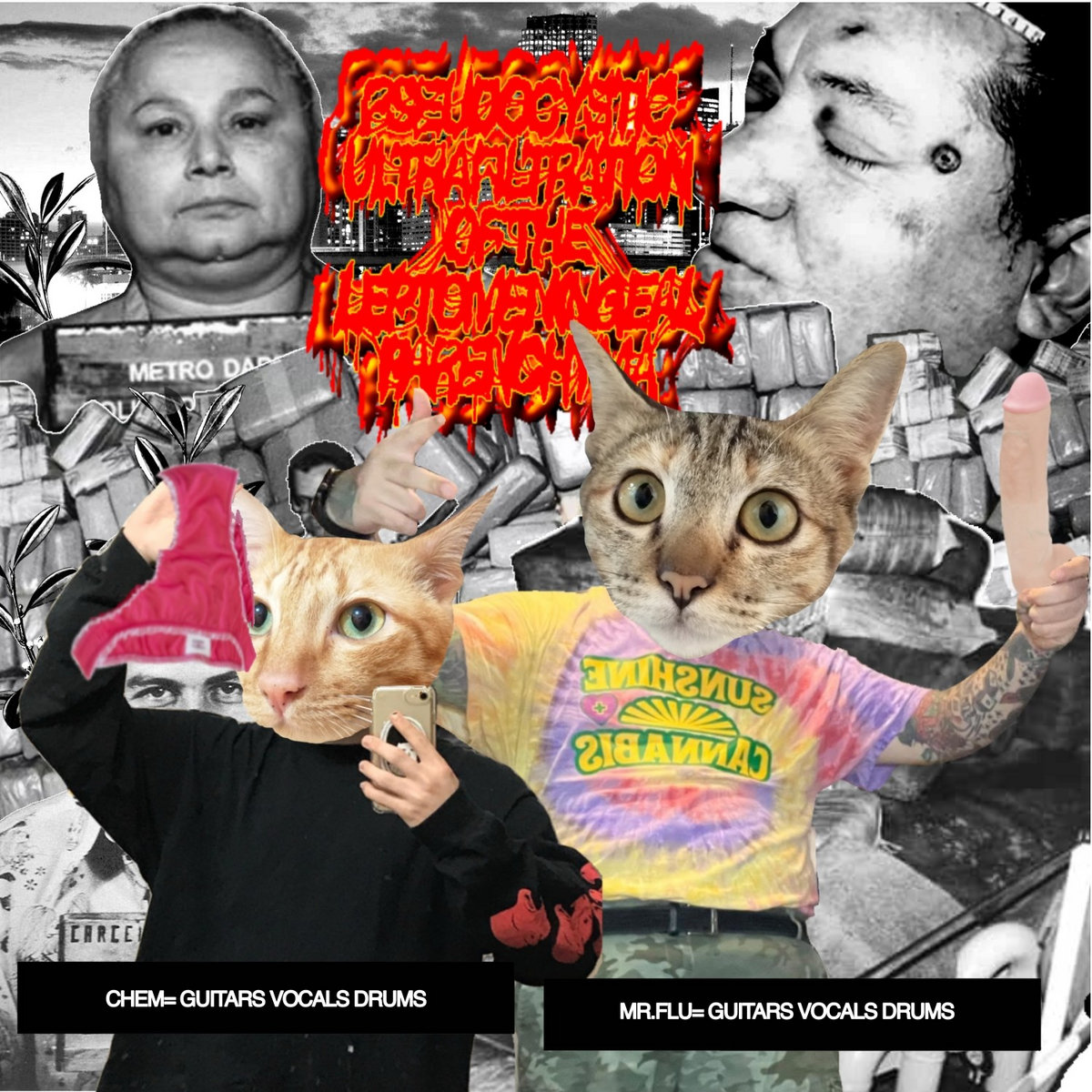 Untitled | PSEUDOCYSTIC ULTRAFILTRATION OF THE LEPTOMENINGEAL PARENCHYMA