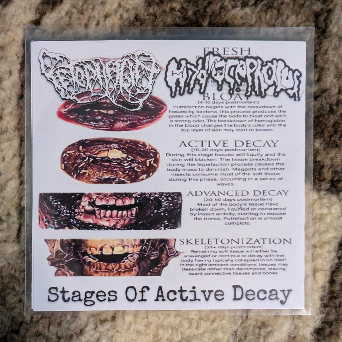 Stages of Active Decay | Fetophagia / Hydrocephalus | Severed Nerve Records