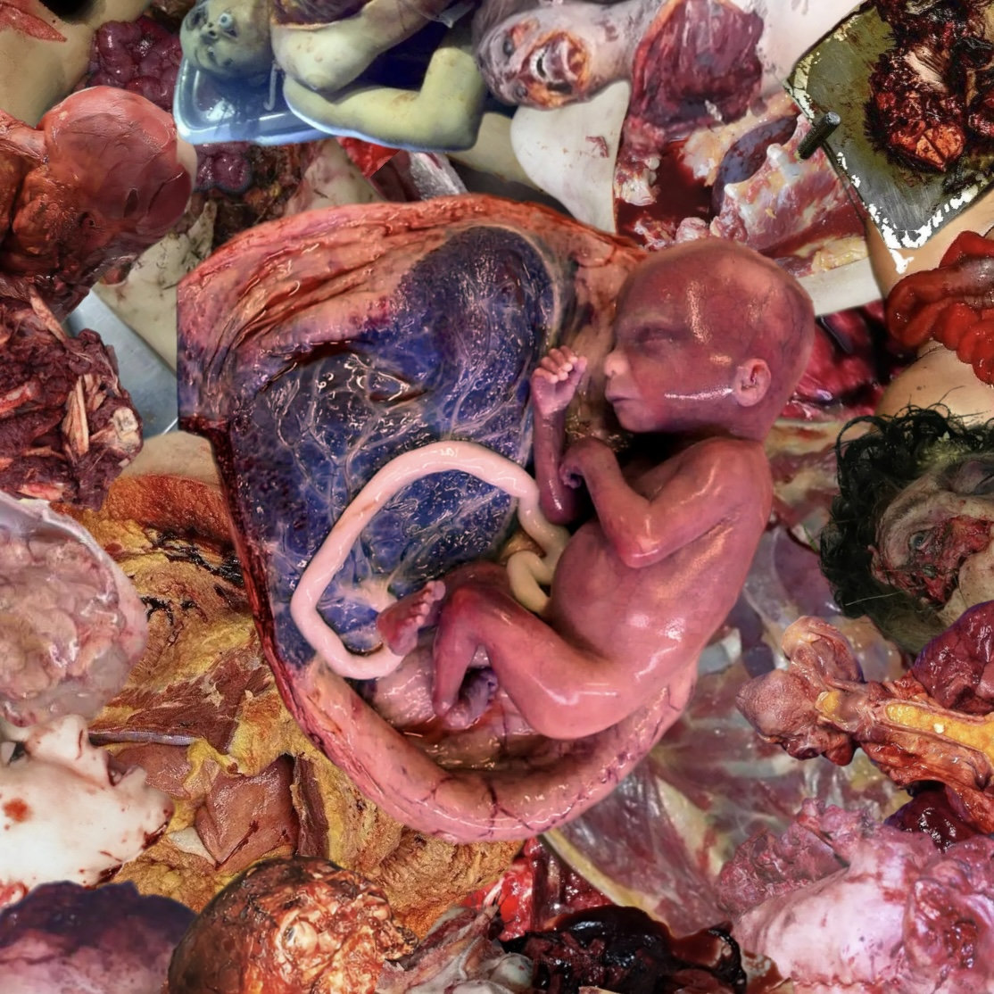 Split W/ Vaginally Consuming Broken Glass | Macrovaginal Afterbirth ...