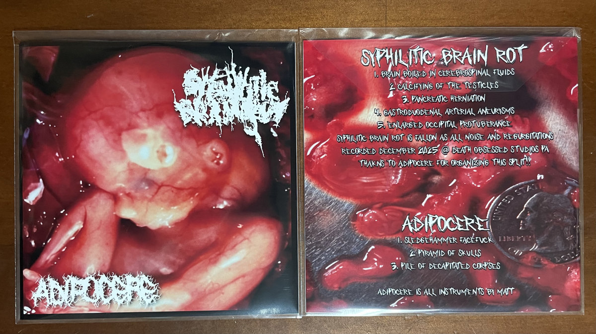 (ADIPOCERE) Pile of Decapitated Corpses | Syphilitic Brain Rot