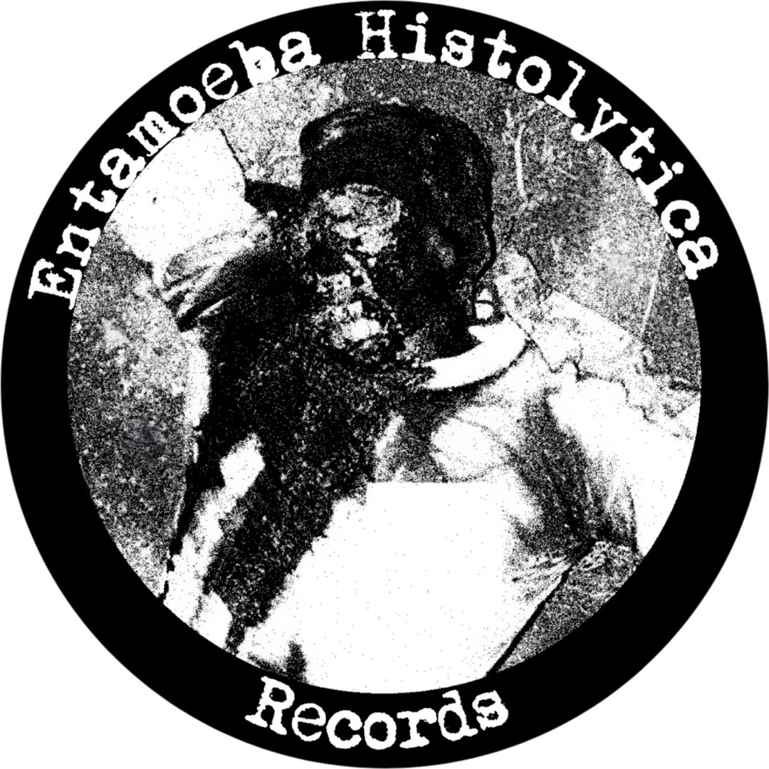 Gangrenosum Epidermis Destroying The Inside Ofthe Skin | Blastocystis ...