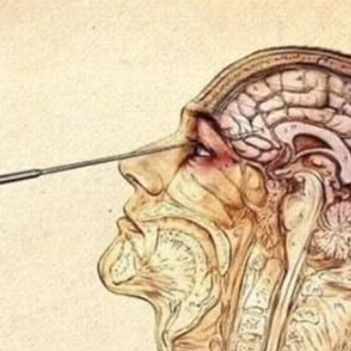 The Lobotomy | Maebi | lalalalala