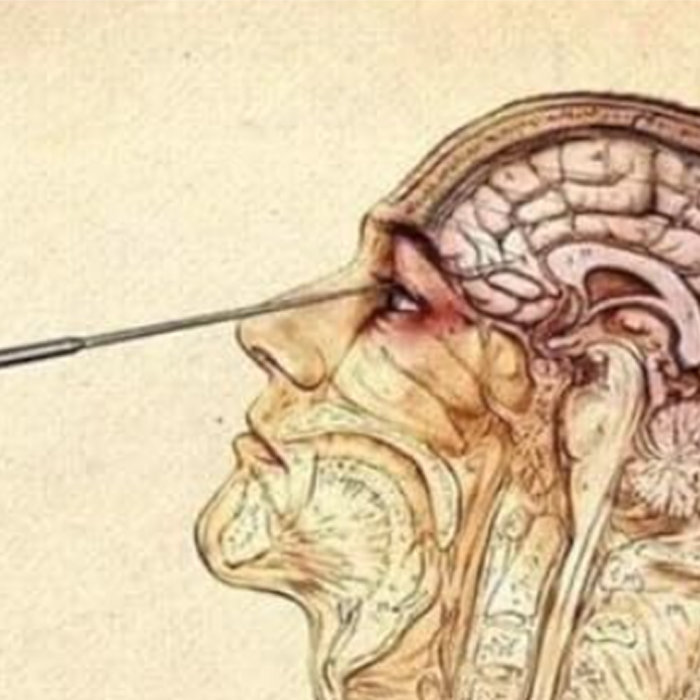 The Lobotomy | Maebi | lalalalala